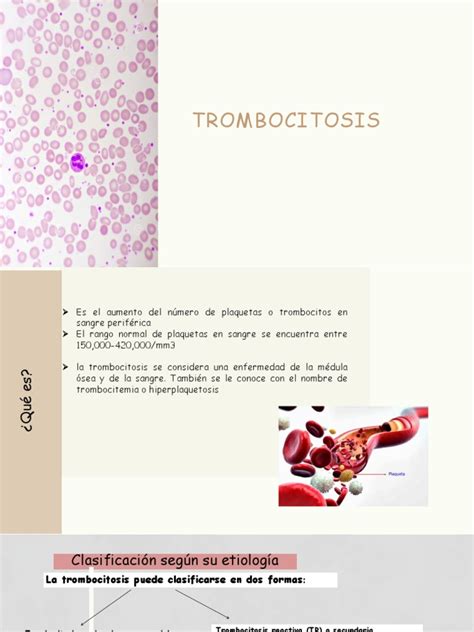 Trombocitosis 2022pptx Pdf Plaqueta Anemia