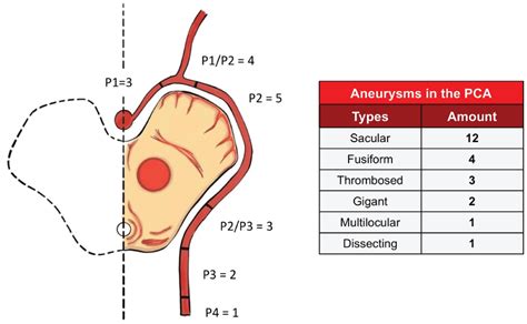 P2 Vs P3 Filter At Jill Deleon Blog