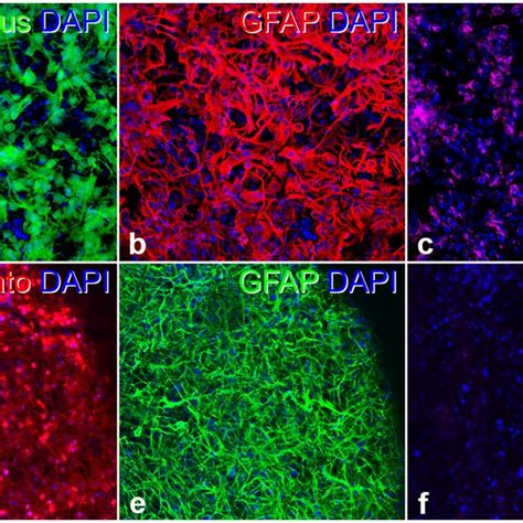 Intravitreally Grafted Cntf Ns Cells Attenuate Photoreceptor