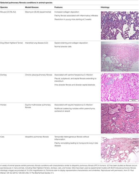 Treatment Stage 4 Ovarian Cancer Prognosis