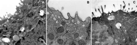 TEM Images Of The Mouse Uterine Plexus Within The Plexus Of Untreated Download Scientific