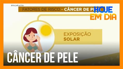 Você E O Doutor Conheça Fatores De Risco Do Câncer De Pele