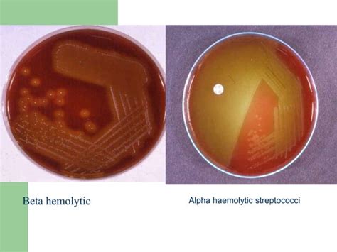 Pneumococcus Ppt