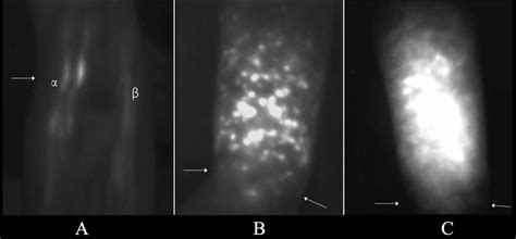 FIG URE A ICG Lymphography Of The Anterior Surface Of A Healthy Download Scientific Diagram