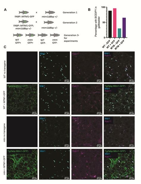 Liver Specific Mtm1 Expression Rescues The Cholestatic Phenotype Of Mtm