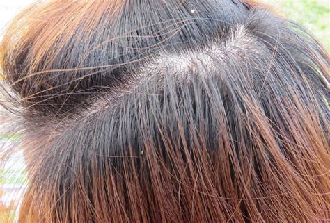How Long Does Permanent Hair Dye Really Last Hairstylecamp