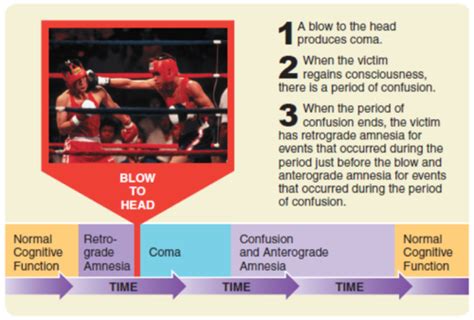 Chapter 11 Learning Memory And Amnesia Flashcards Quizlet