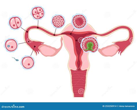 Stages Of Uterine Prolapse Female Reproductive Organs Diagram And