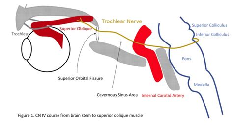 Trochlear Nerve Pathway