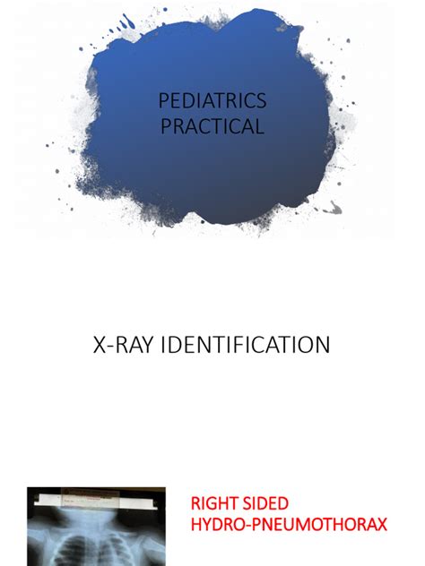 Pediatrics Practical Pdf Fat Intravenous Therapy