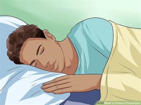 How To Prevent Chickenpox 6 Steps With Pictures Wikihow