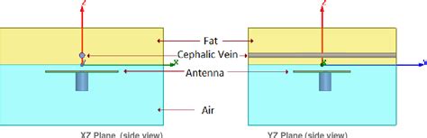RF Sensing System For Continuous Blood Glucose Monitoring Semantic Scholar