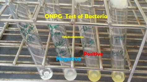 Microbial Diagnostic Disks Introduction List Of Disks Uses And