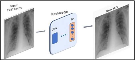 Figure From Deep Learning Model For Thorax Diseases Detection Semantic Scholar