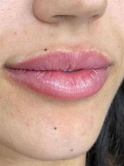 Cosmetic Surgery Sacramento Med Spa El Dorado Hills Esthetics Center