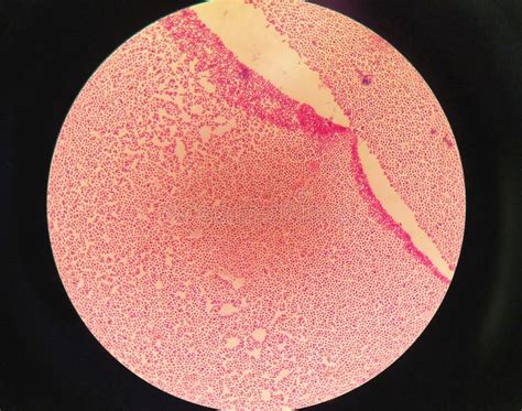 Gram Staining Is A Method Of Differentiating Bacterial Species Gram