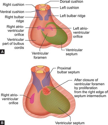 Interventricular Septum Development 2010 Lecture 21 Embryology