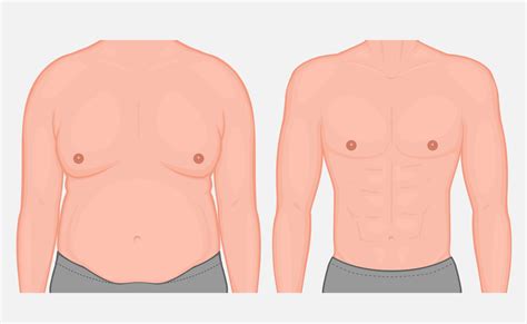 Jinekomasti Nedir Nasıl Tedavi Edilir Fit Hub