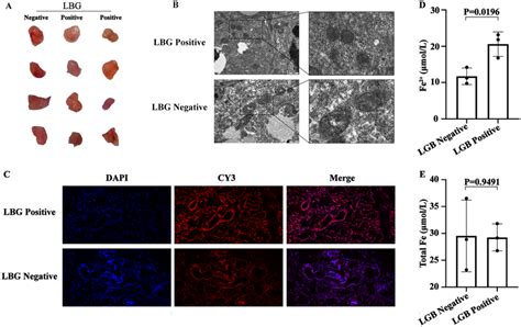 Detection Of Ferroptosis In Labial Gland Tissue Of Pss Patients A