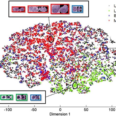 2d Visualization Of The Feature Space From Nuclei Figure Classification