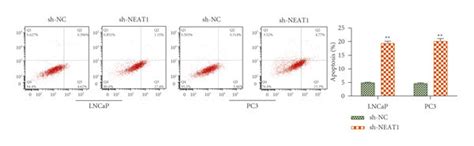 Knockdown Of NEAT1 Inhibited Cell Progression In Prostate Cancer A