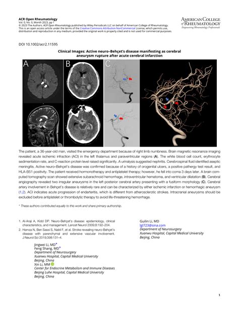 Pdf Clinical Images Active Neuro Behçets Disease Manifesting As Cerebral Aneurysm Rupture