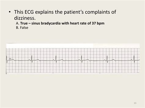 12 Lead Ekg Interpretation Pdfdrive Pdf