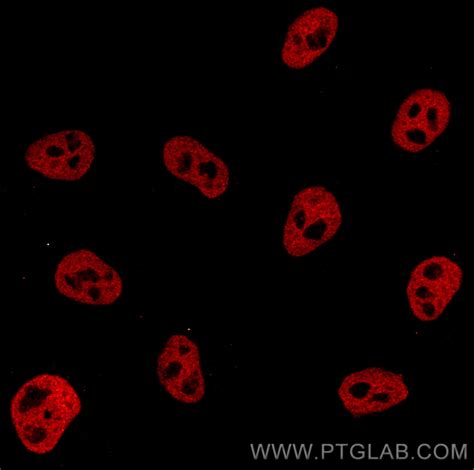 Flexable Coralite® Plus 555 Antibody Labeling Kit For Mouse Igg2b