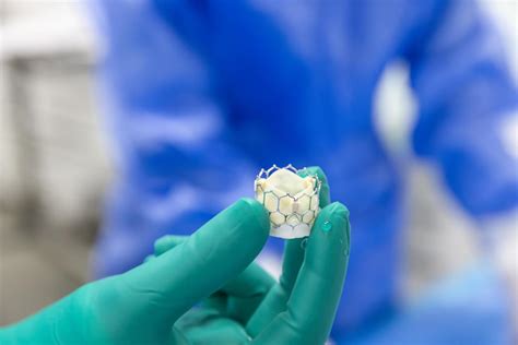 Transcatheter Aortic Valve Replacement Tavr Division Of Cardiology