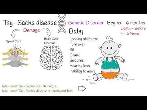 Taysachs Disease Symptoms Early Signs And Prevention Youtube