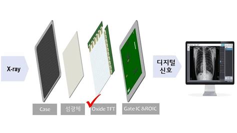 Lg Display Develops New Film Transistor For Digital X Ray Detectors Zdnet