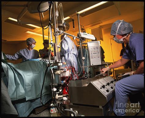 Heart Bypass Surgery