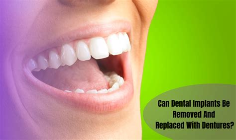 Removing Dental Implants With Dentures Is It Possible