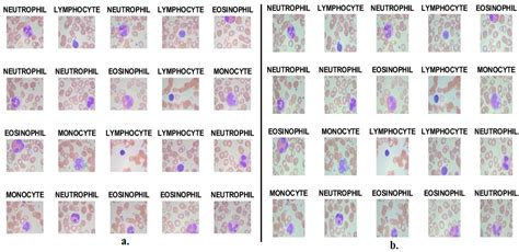 Diagnostics Free Full Text Blood Slide Image Analysis To Classify