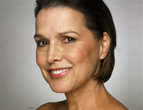 Under Eye Bags Removal Chicago Oculofacial Consultants
