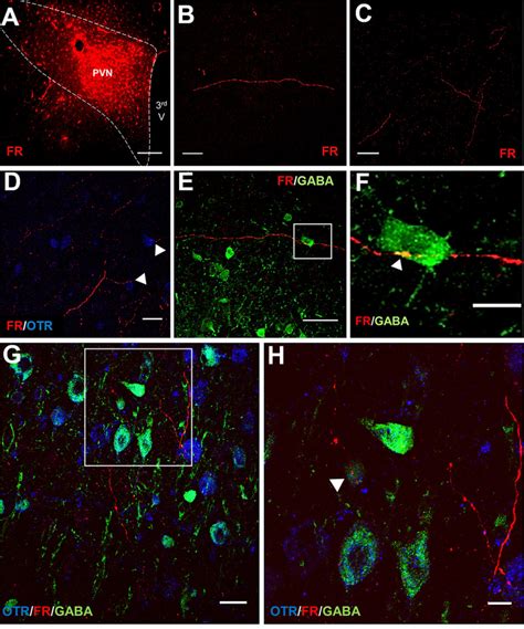 The Rostral Agranular Insular Cortex A New Site Of Oxytocin To Induce