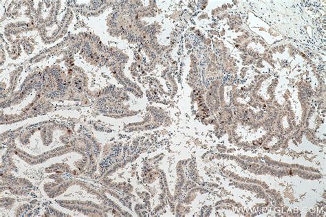 Ihceasy Tk1 Ready To Use Ihc Kit Khc0765 Proteintech 武汉三鹰生物技术有限公司
