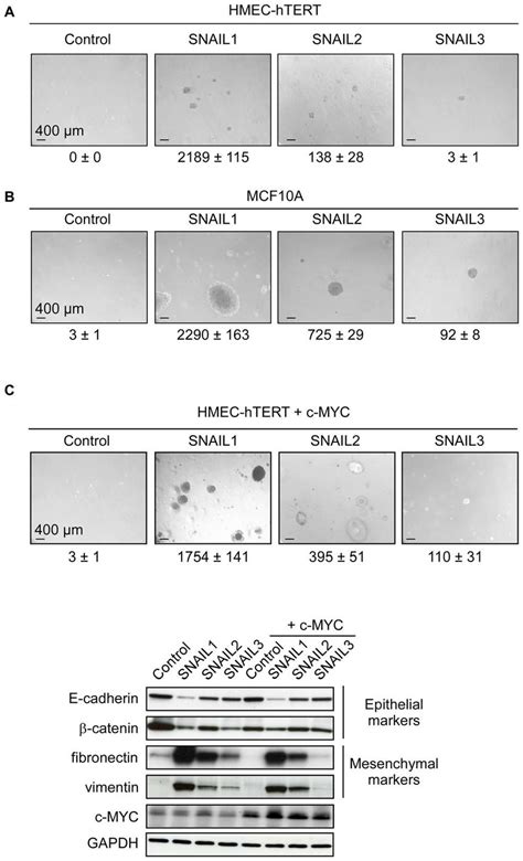 Snail Proteins Are Sufficient To Promote Mammary Epithelial Cell