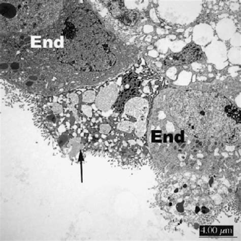 Electron Micrographs Of 12 Day Rat Yolk Sac Endoderm Showing A