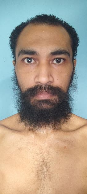 Premium Photo Face A Melanesian Men From Asia