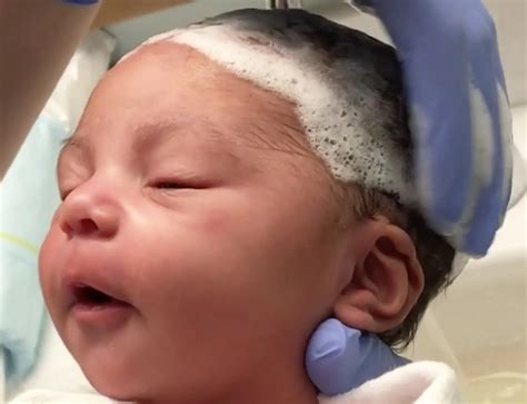 4 Cradle Cap Tips From Easton Dermatology Associates