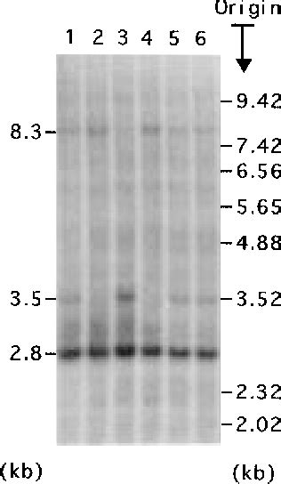 Figure 1 From Sac I Restriction Fragment Length Polymorphism Rflp Related To The Human Cst2