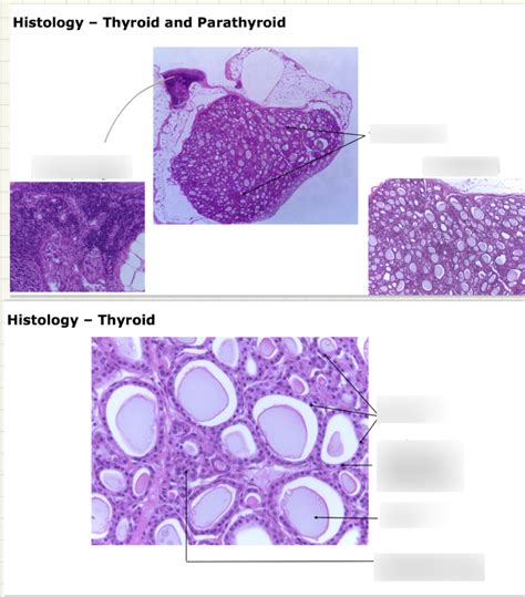 Thyroid And Parathyroid Histology Diagram Quizlet