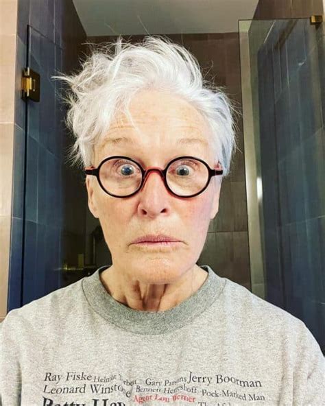 76 Year Old Glenn Close Shocks Fans With Bruised Face In New Photo