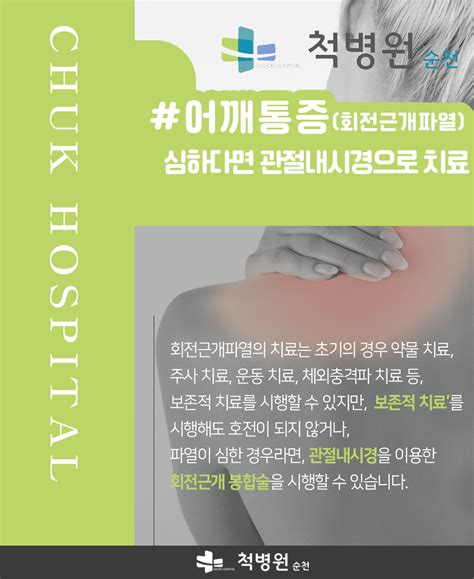어깨통증 회전근개파열 치료 방법은 소셜채널