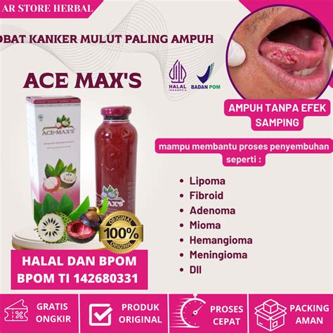 Jual Obat Kanker Mulut Paling Ampuh Mulut Terasa Kebas Mati Rasa Pendarahan Pada Lidah