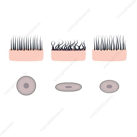 Hair Types Conceptual Illustration Stock Image F Science Photo Library