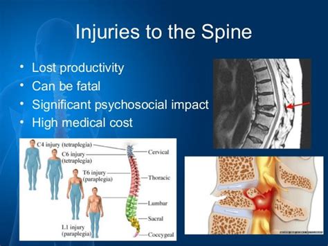Spinal Immobilization Treatment Or Torture