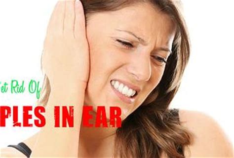 How To Get Rid Of Pimples In Ear Medicinal Natural Tips Paperblog