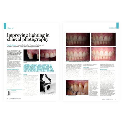 Dipesh Kothari On Linkedin New Article Out In This Months Dentistry